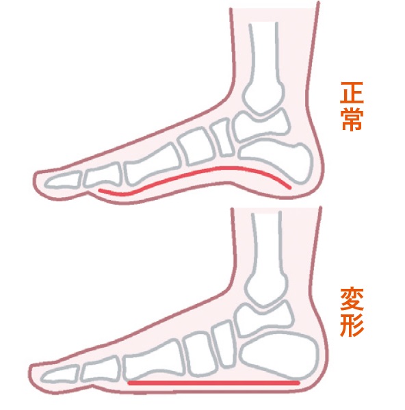 【美脚エクササイズ】足指&足首ほぐしで“足裏アーチ”を正常に！（ananweb）